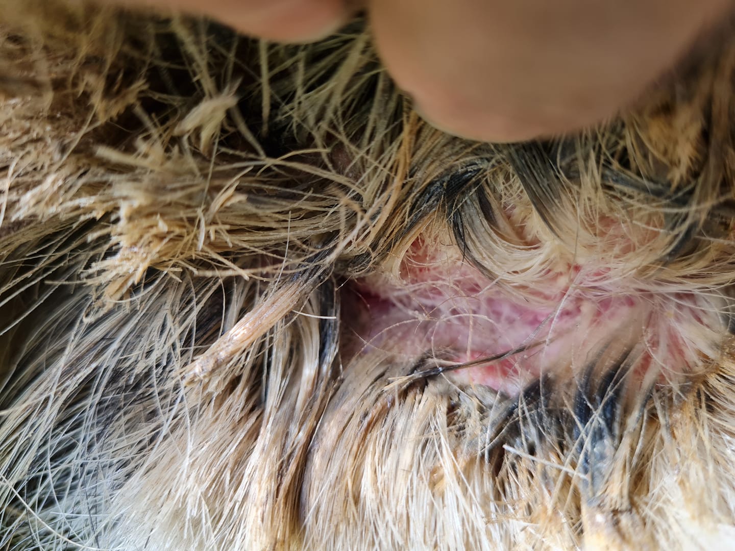 Intertrigo – Chronic Progressive Lymphoedema