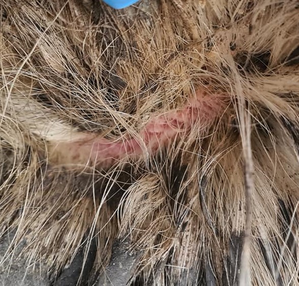 Intertrigo – Chronic Progressive Lymphoedema