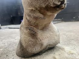 Intertrigo – Chronic Progressive Lymphoedema