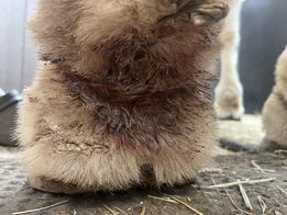 Intertrigo – Chronic Progressive Lymphoedema